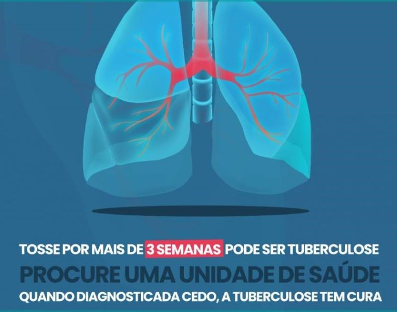 24 De MarÇo Dia Mundial De Combate À Tuberculose Otics Rio Padre Miguel